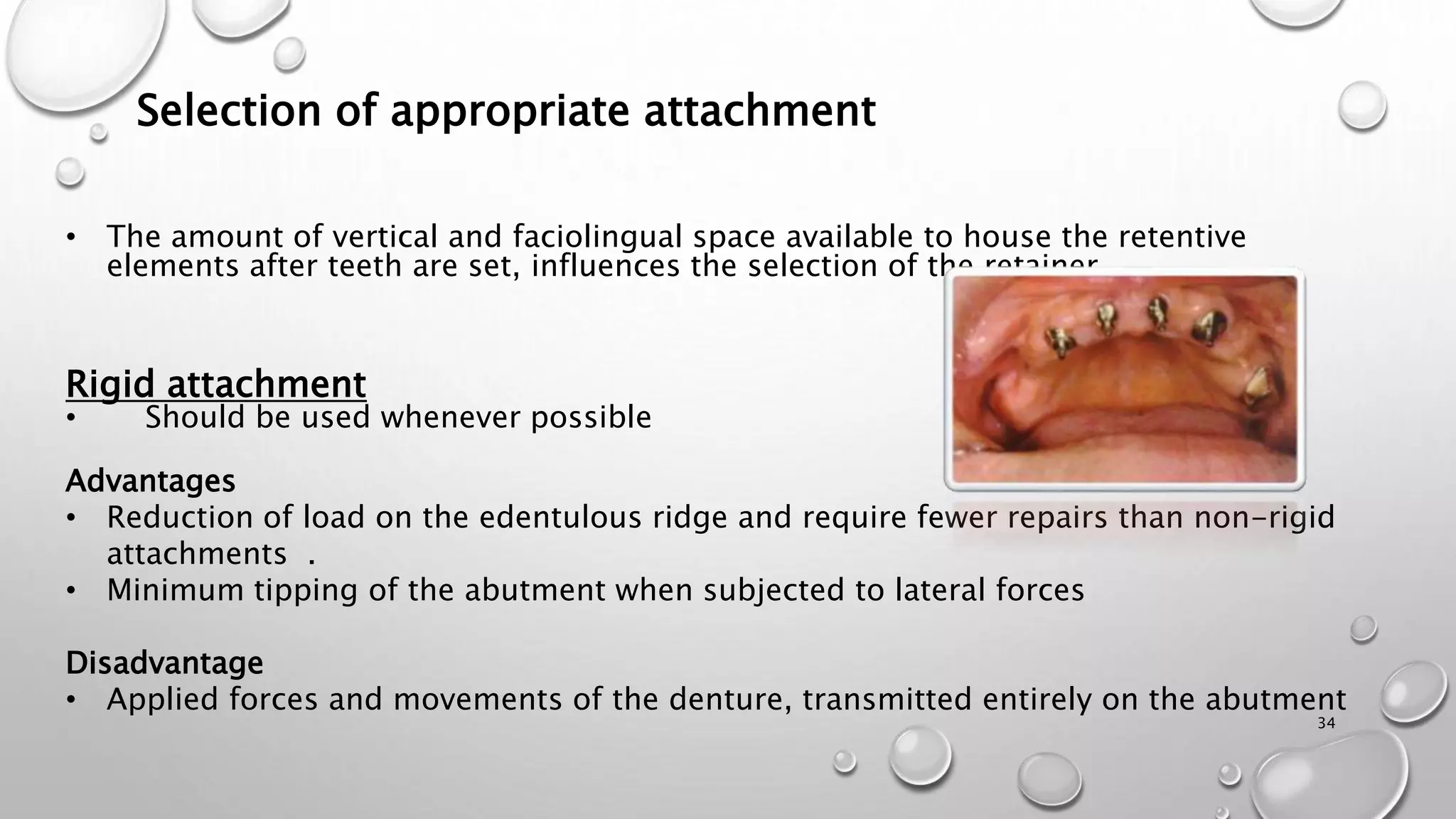 Overdentures | PPTX