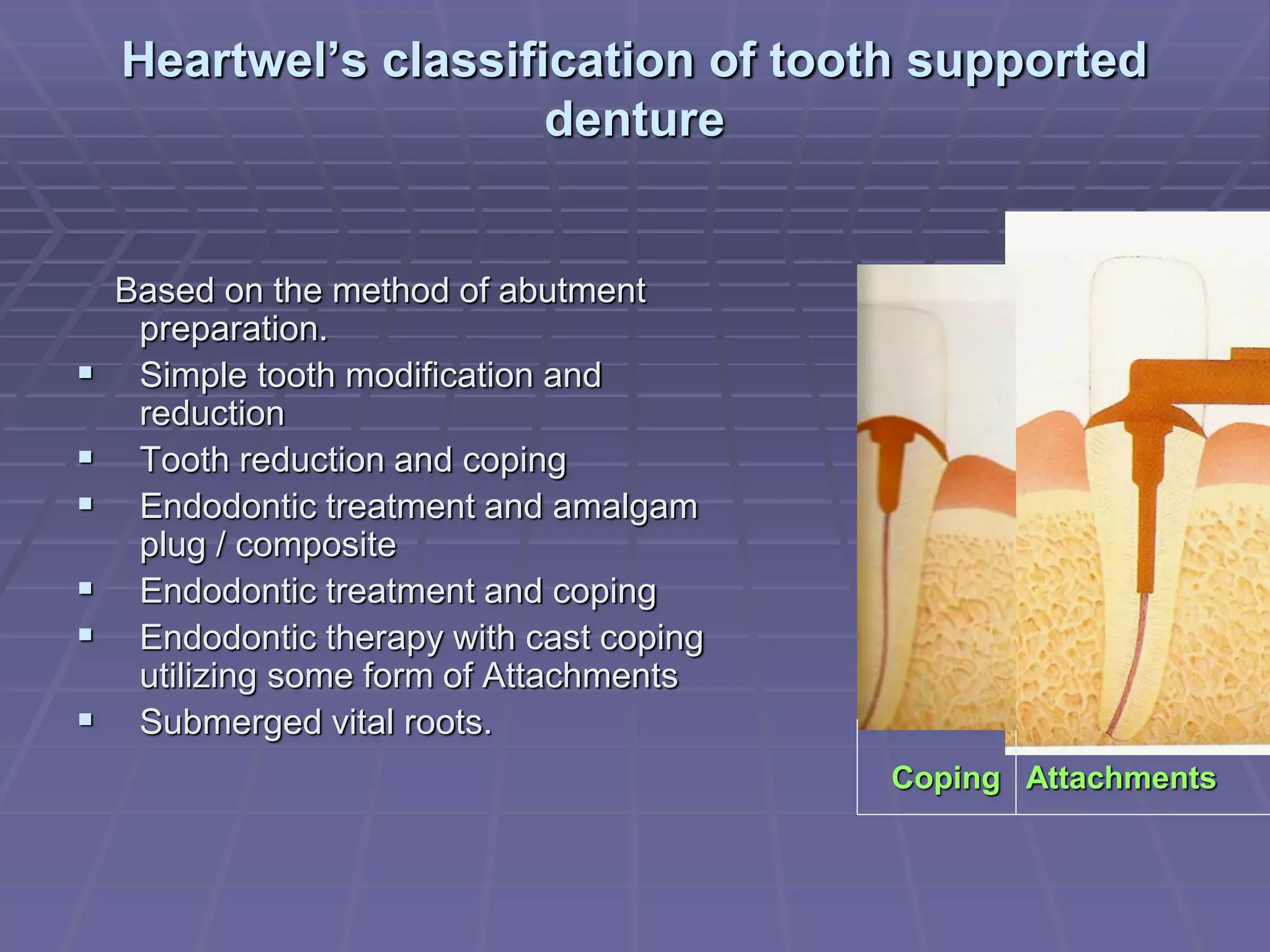 Overdentures - Indications, Contraindication and Treatment Procedure.ppt