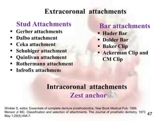 Over dentures and its attachment | PPTX