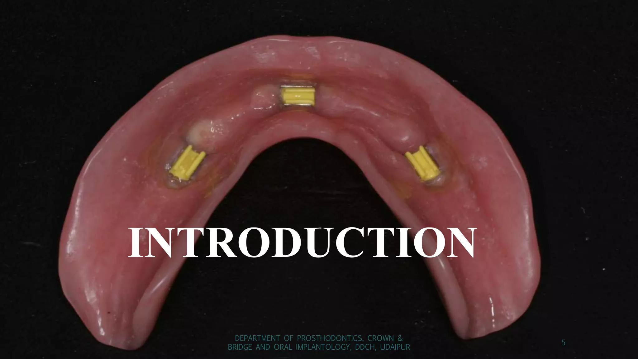 tooth supported Overdentures | PPTX