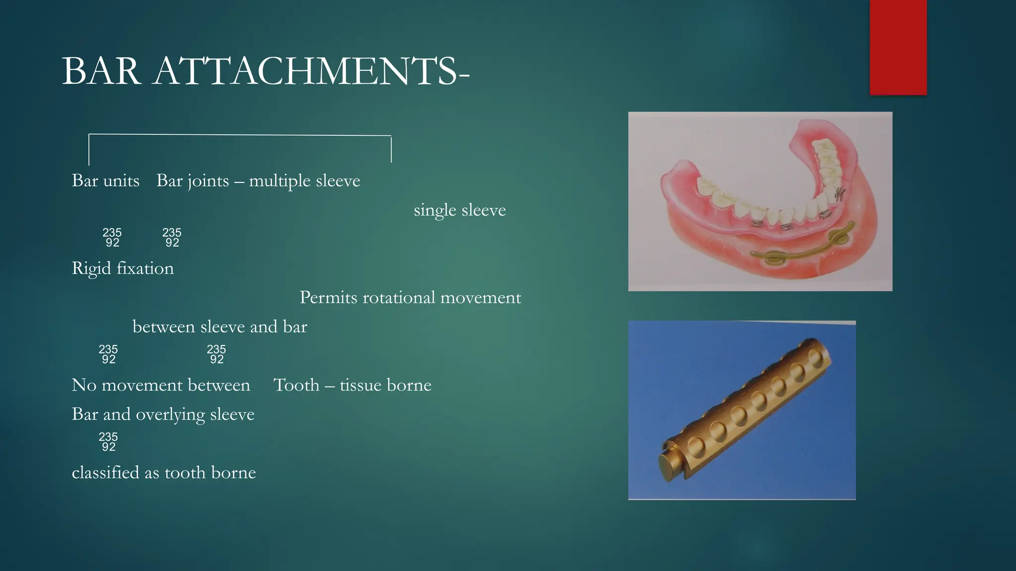 OVERDENTURESS.pptx department of prosthodotics | PPTX