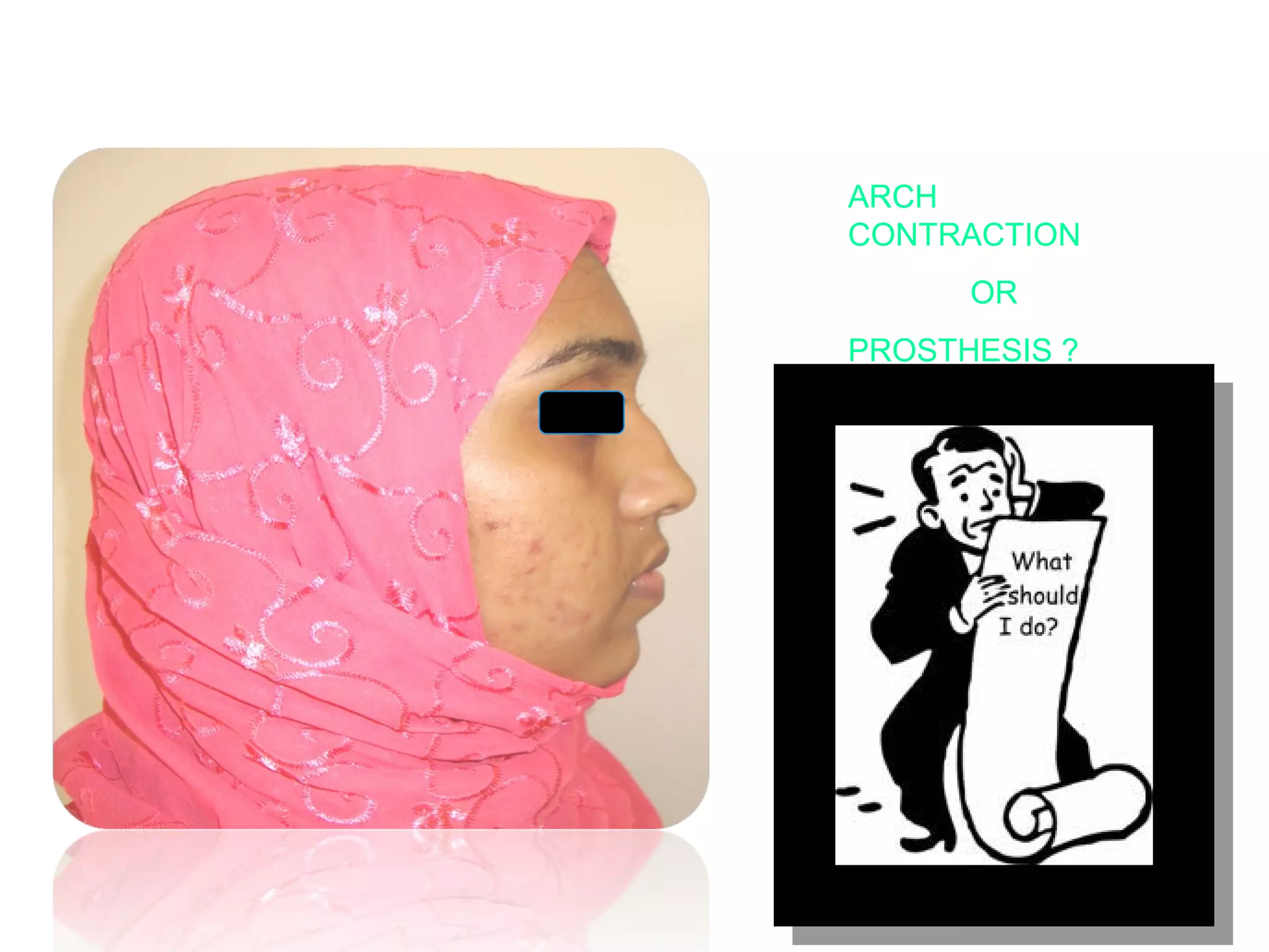 Overjet reduction(2) | PPT