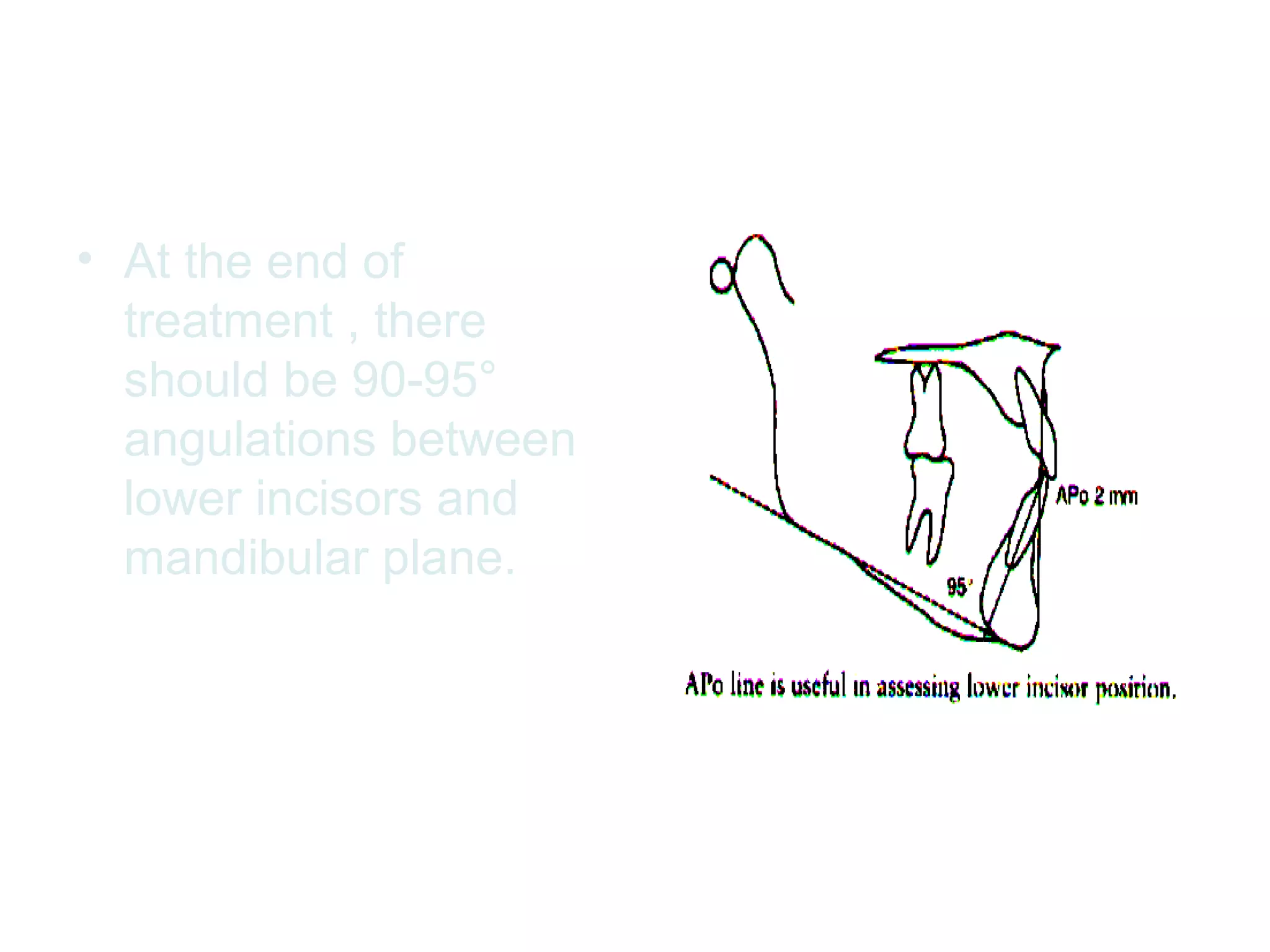 Overjet reduction(2) | PPT