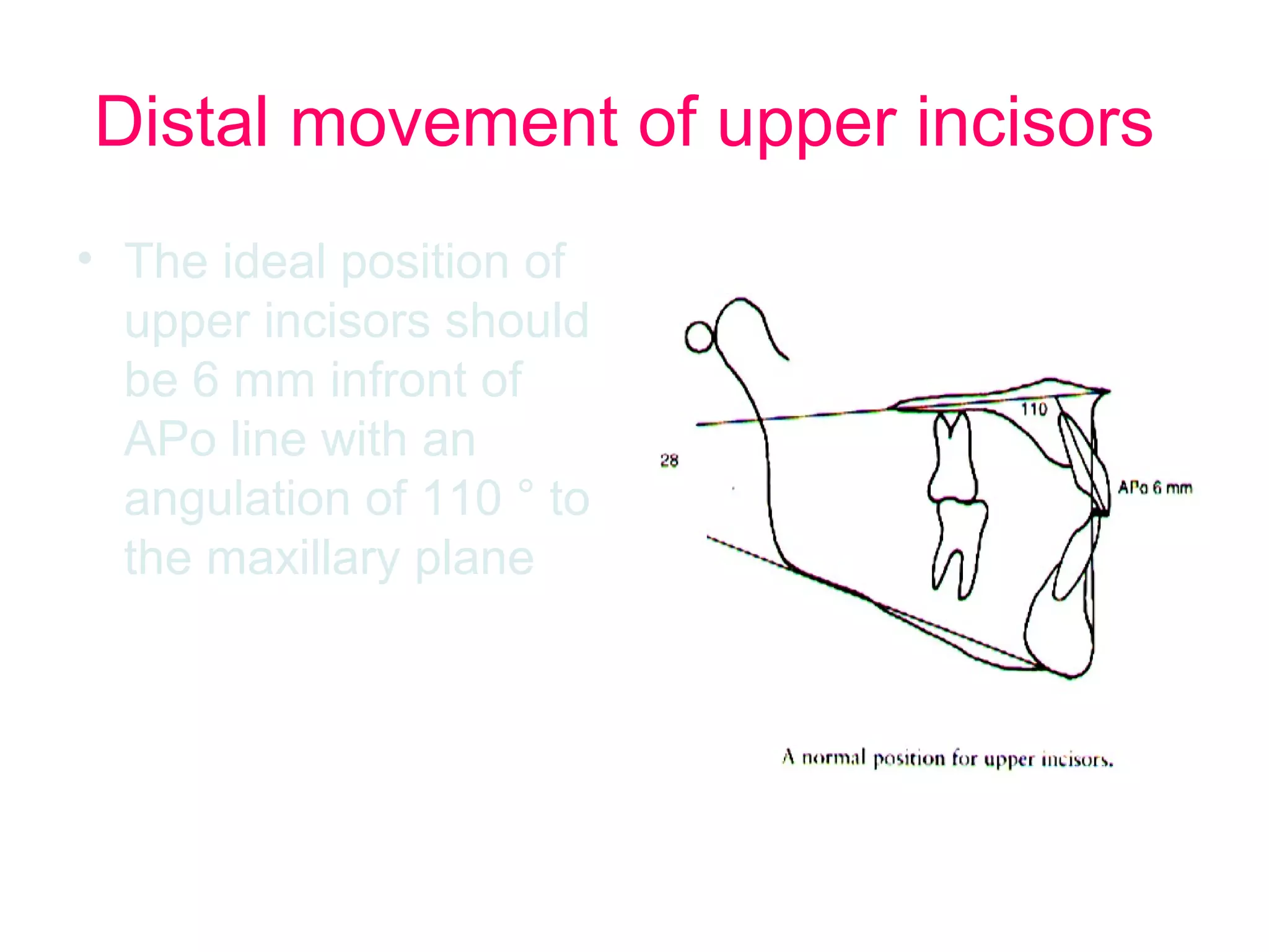 Overjet reduction(2) | PPT