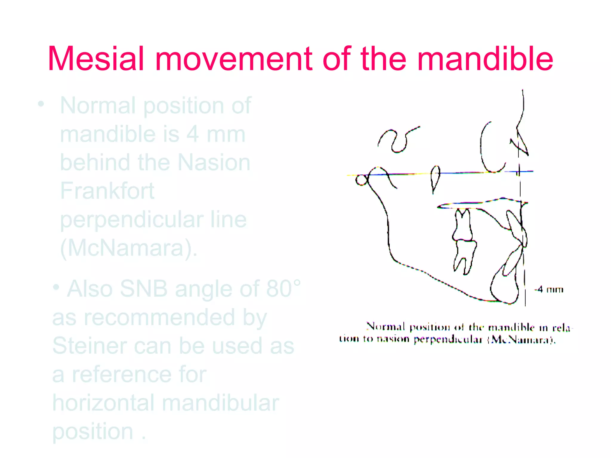 Overjet reduction(2) | PPT