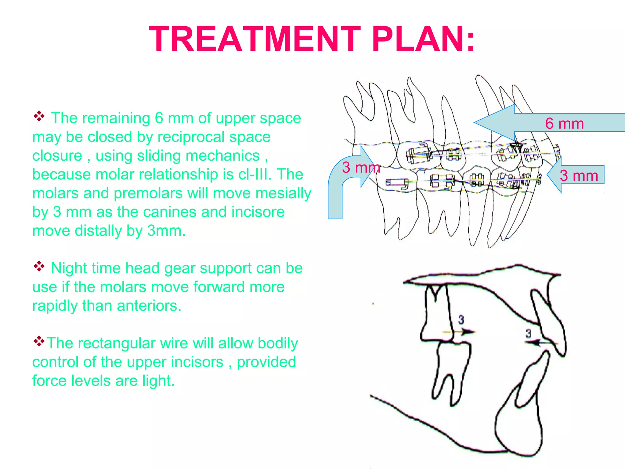 Overjet reduction(2) | PPT