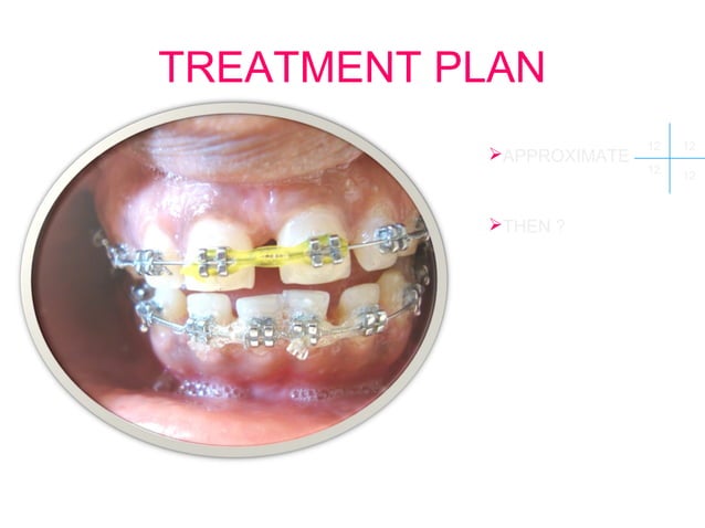 Overjet reduction(2) | PPT