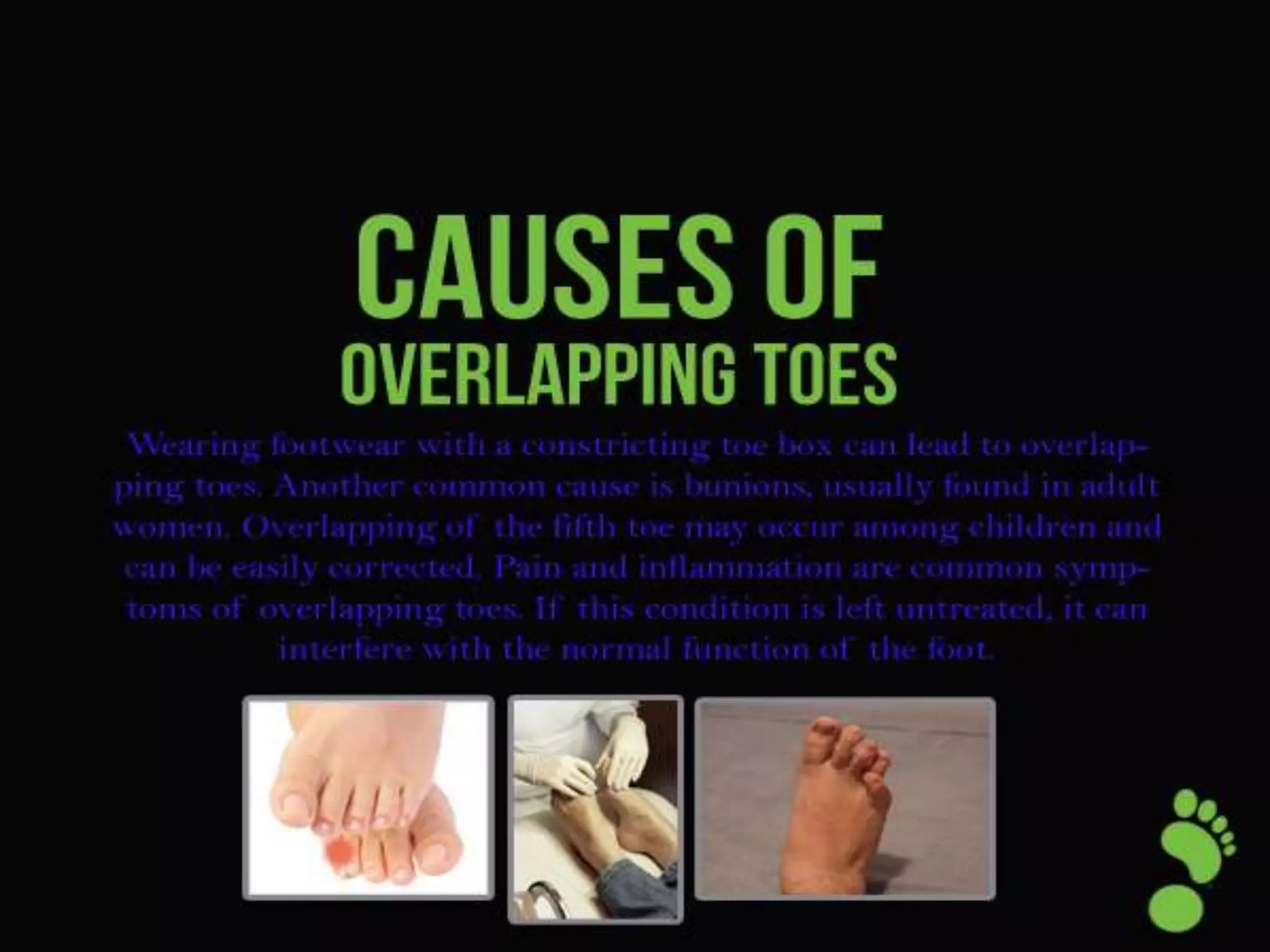 Overlapping toes | PPTX