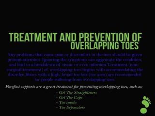 Overlapping toes | PPTX