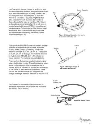 Overstitch - detailed info on this new endoluminal platform | PDF