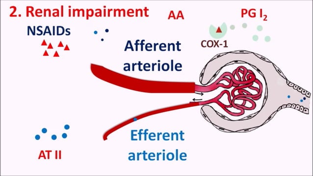 Overuse and Misperceptions of NSAIDs (Final) - Copy.pptx
