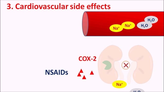 Overuse and Misperceptions of NSAIDs (Final) - Copy.pptx