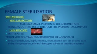 Overview and eligibility female sterilisation | PPTX