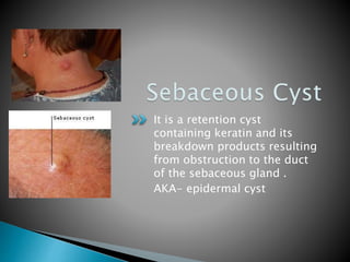 Overview lumps and bumps | PPTX