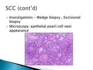 Overview lumps and bumps | PPTX