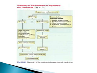 Overview lumps and bumps | PPTX
