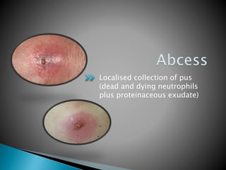 Overview lumps and bumps | PPTX