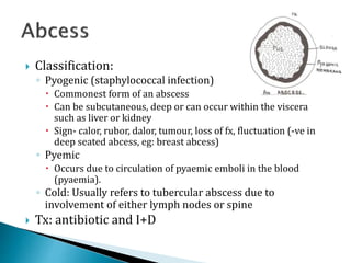 Overview lumps and bumps | PPTX