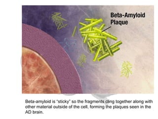 Overview of Alzheimer's disease | PPT