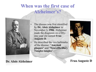 Overview of Alzheimer's disease | PPT