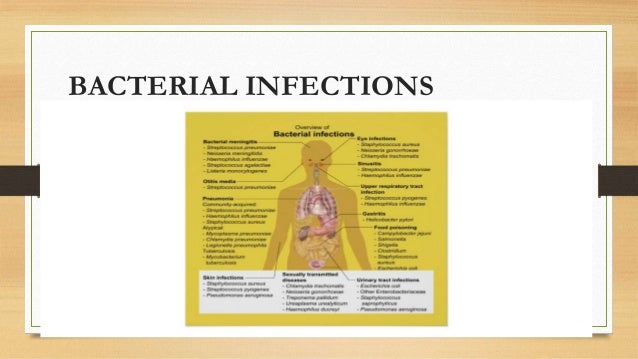 Overview of bacterial infections