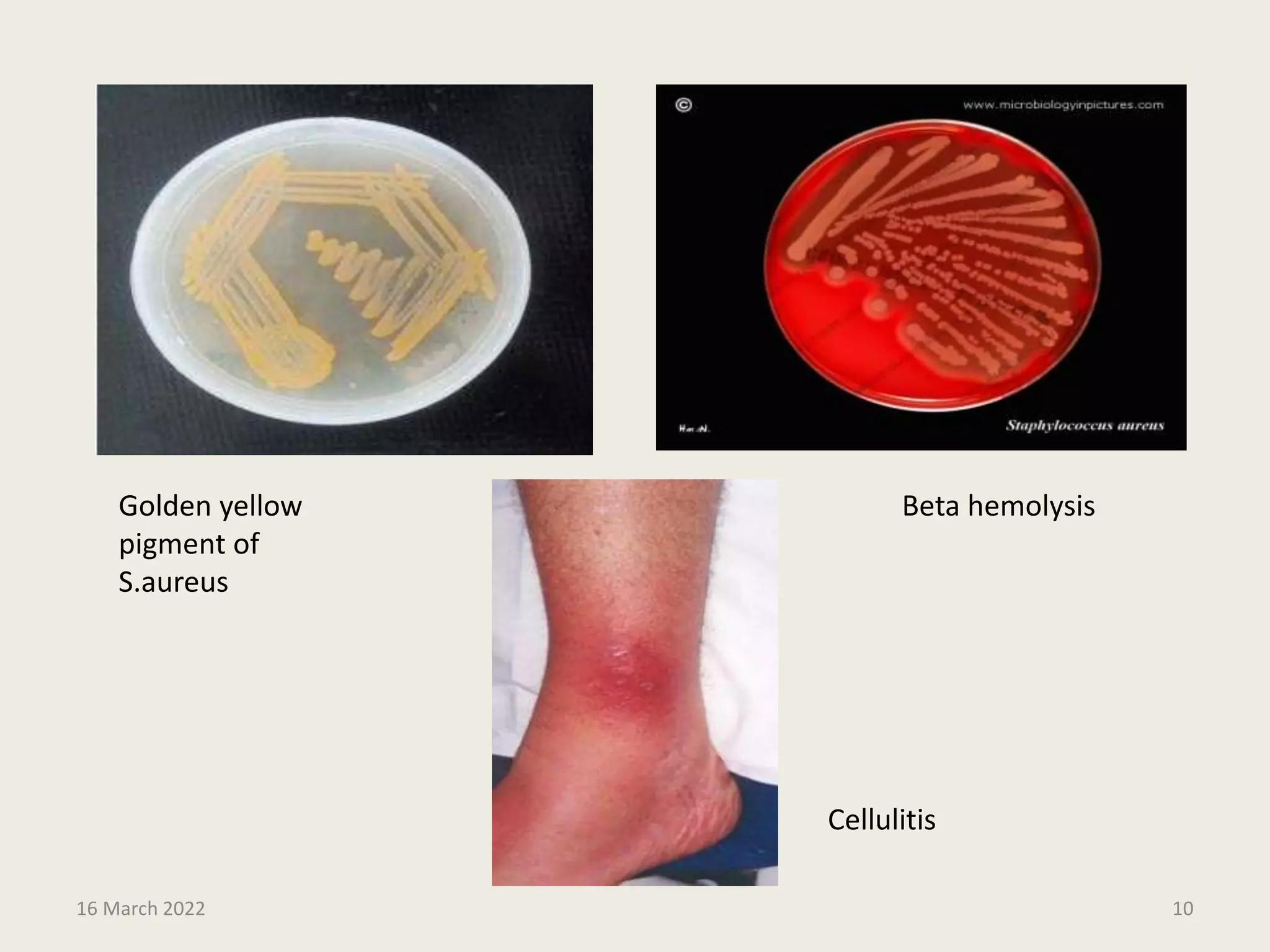 Overview of bacterial infections | PPTX