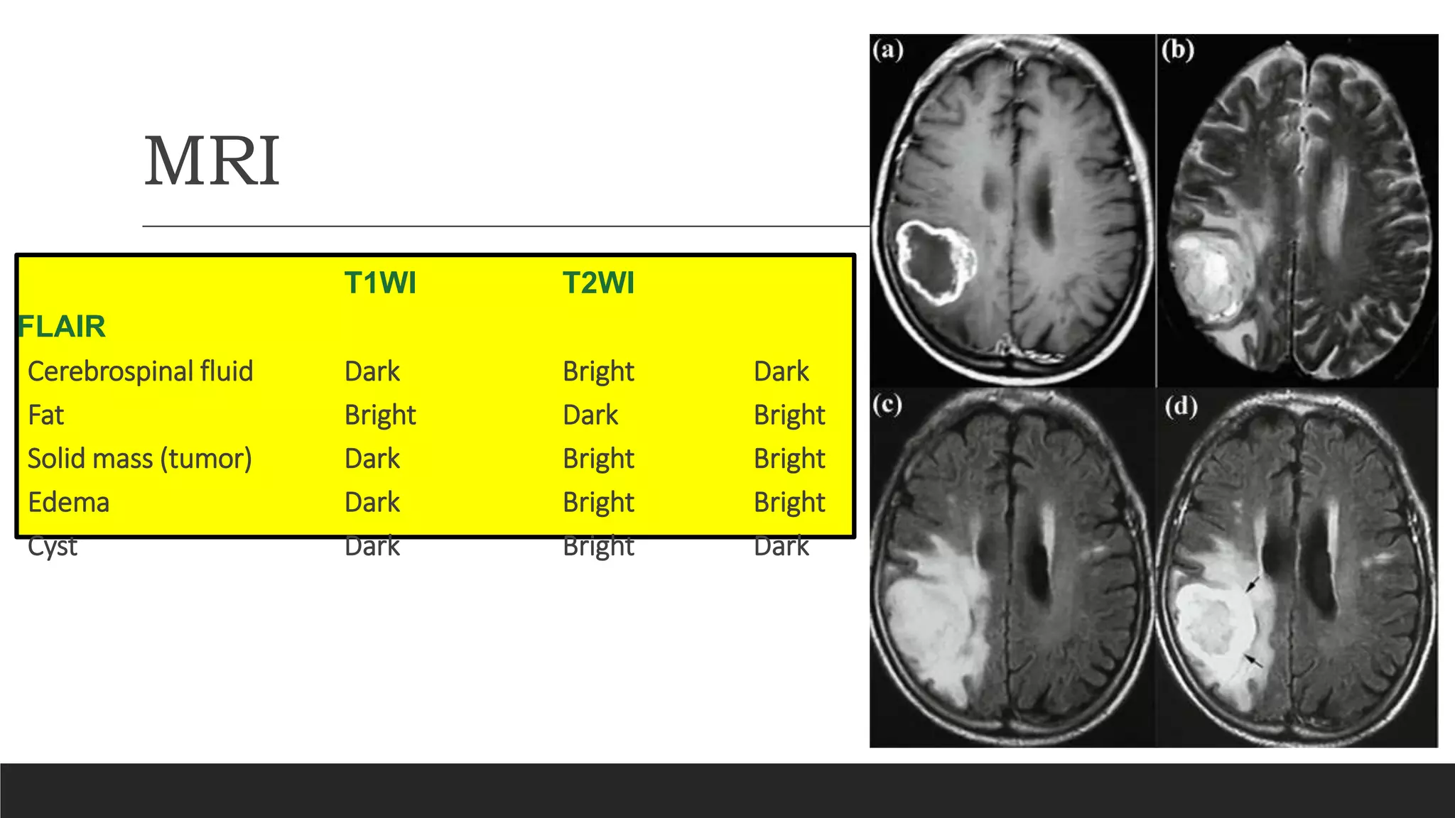 Overview of brain tumors | PPTX