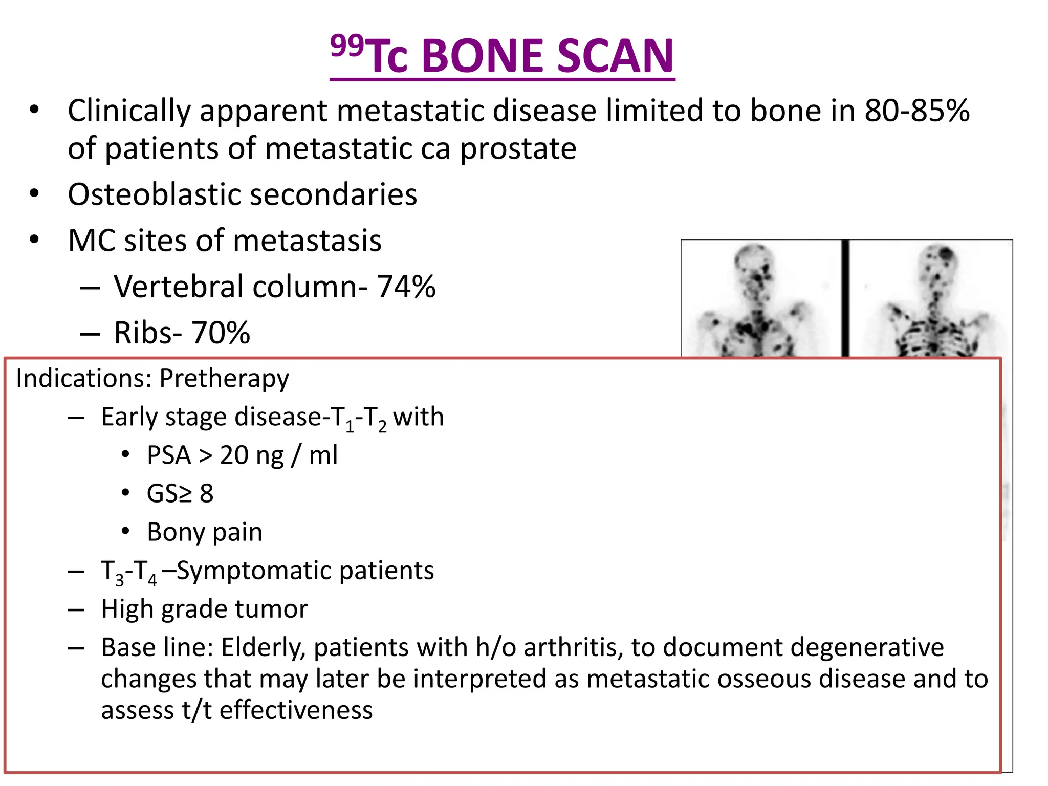 Overview of Carcinoma Prostate and Genetics | PPTX