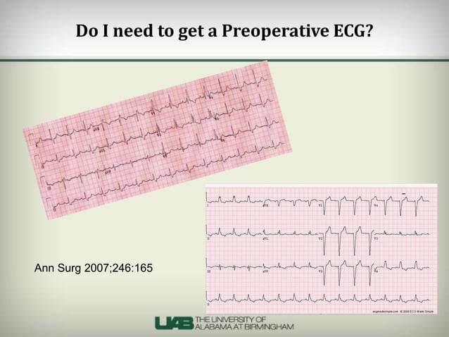 Overview of preoperative cardiac risk assessment | PPTX
