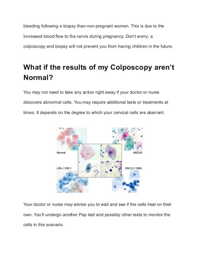 Overview of Colposcopy.pdf