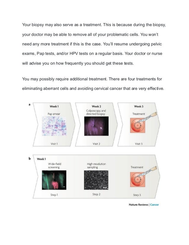 Overview of Colposcopy.pdf