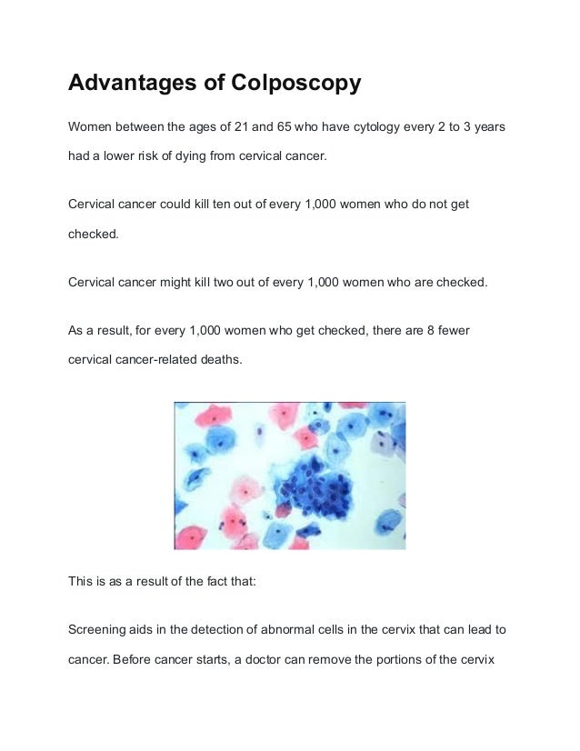 Overview of Colposcopy.pdf