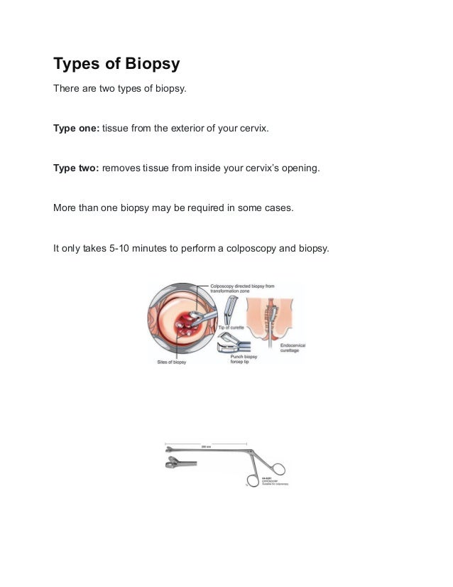 Overview of Colposcopy.pdf