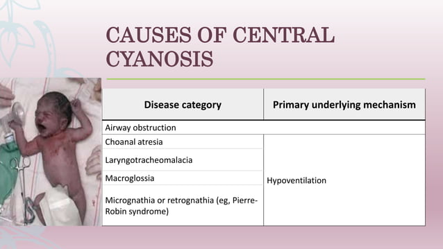 Overview of cyanosis in the newborn