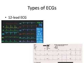 Overview of ecg part 1 | PPTX