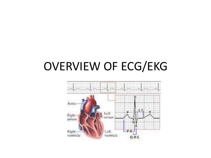 Overview of ecg part 1