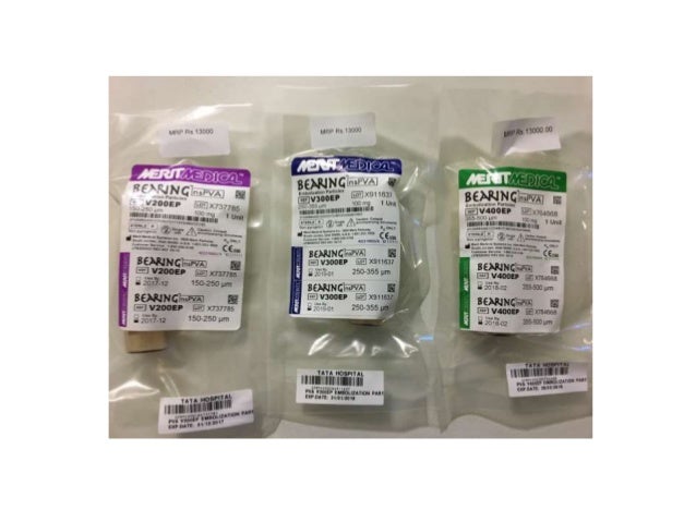 Overview of embolizing agents