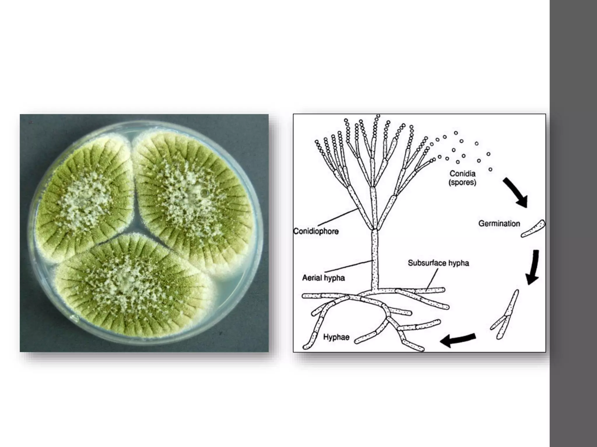 Overview of Fungal Infections | PDF