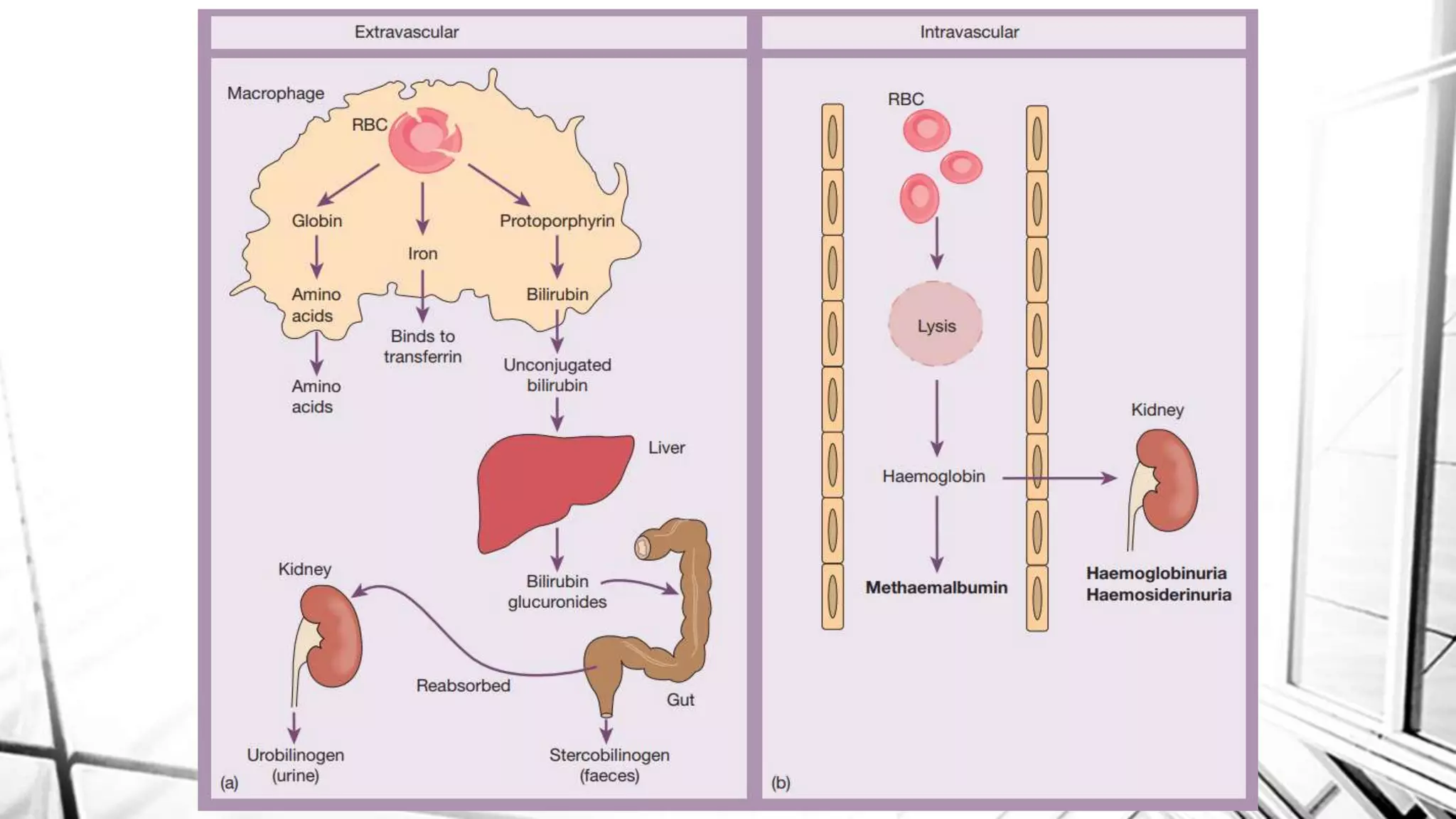 Overview of hemolytic anemia Both Intra and Extravascular | PPTX