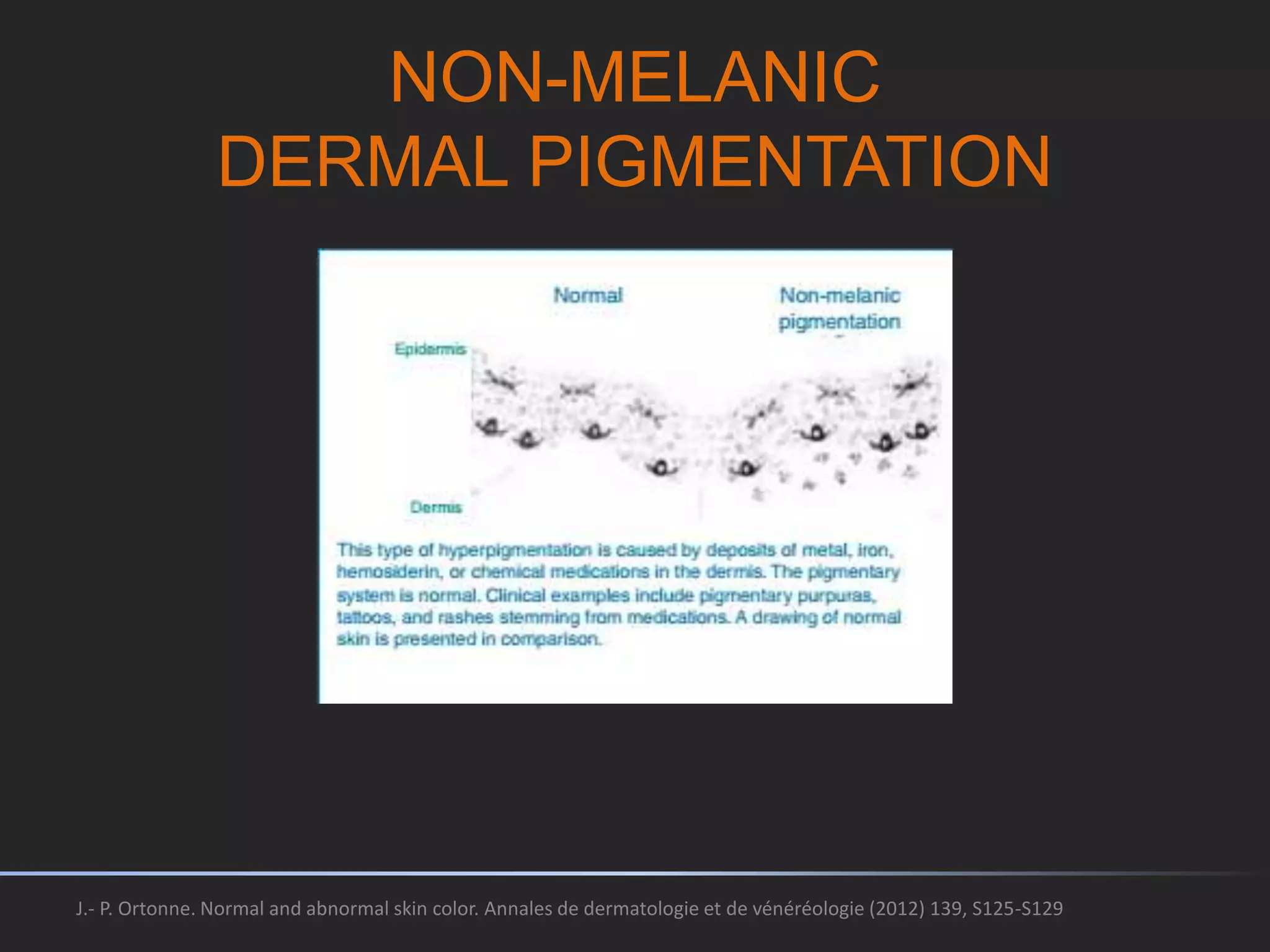Overview of hyperpigmentation disorders | PPTX