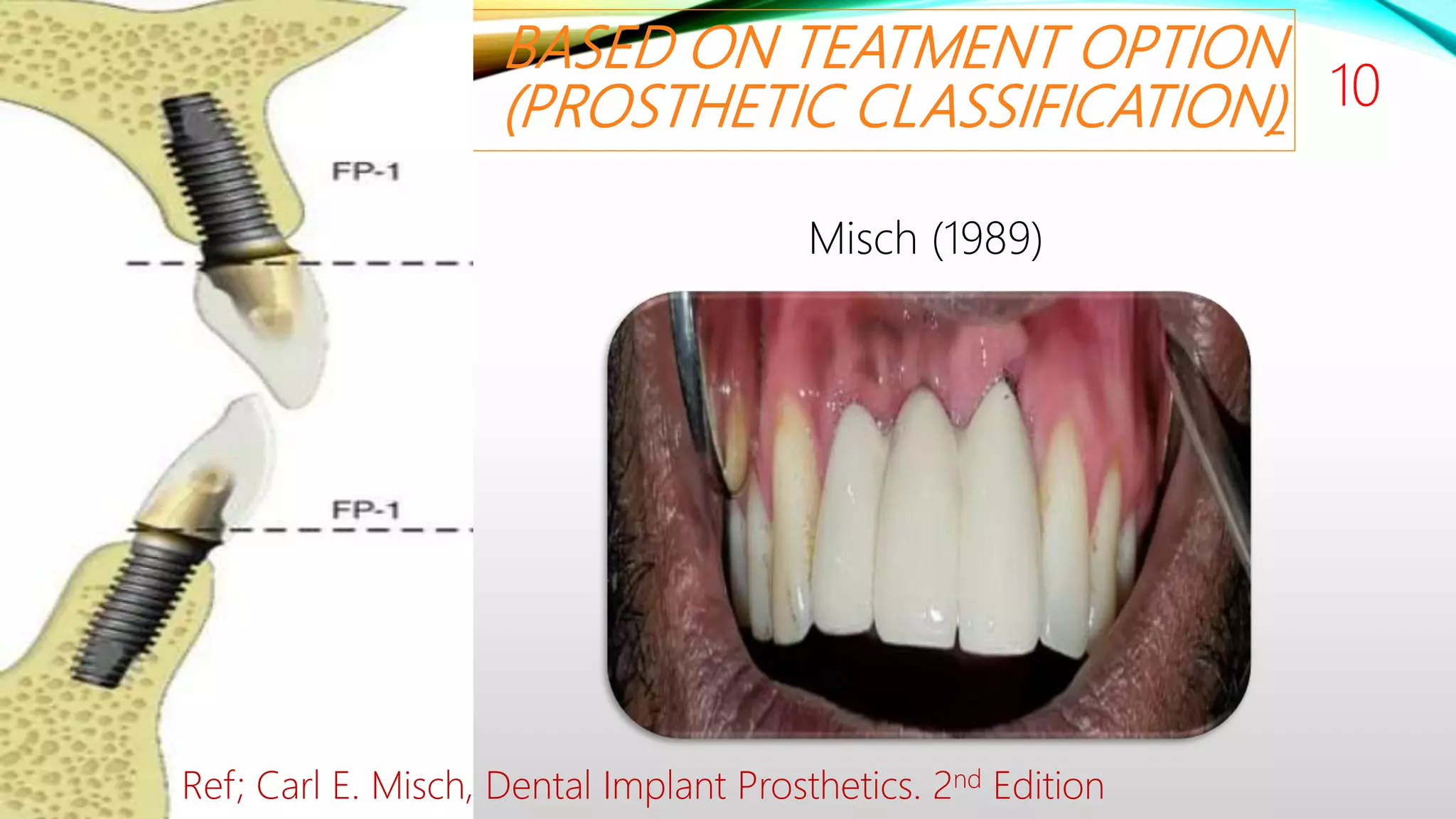 Overview of impression technique in implant dentistry.pptx