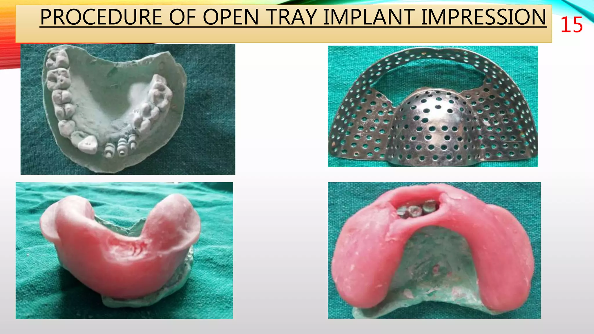 Overview of impression technique in implant dentistry.pptx