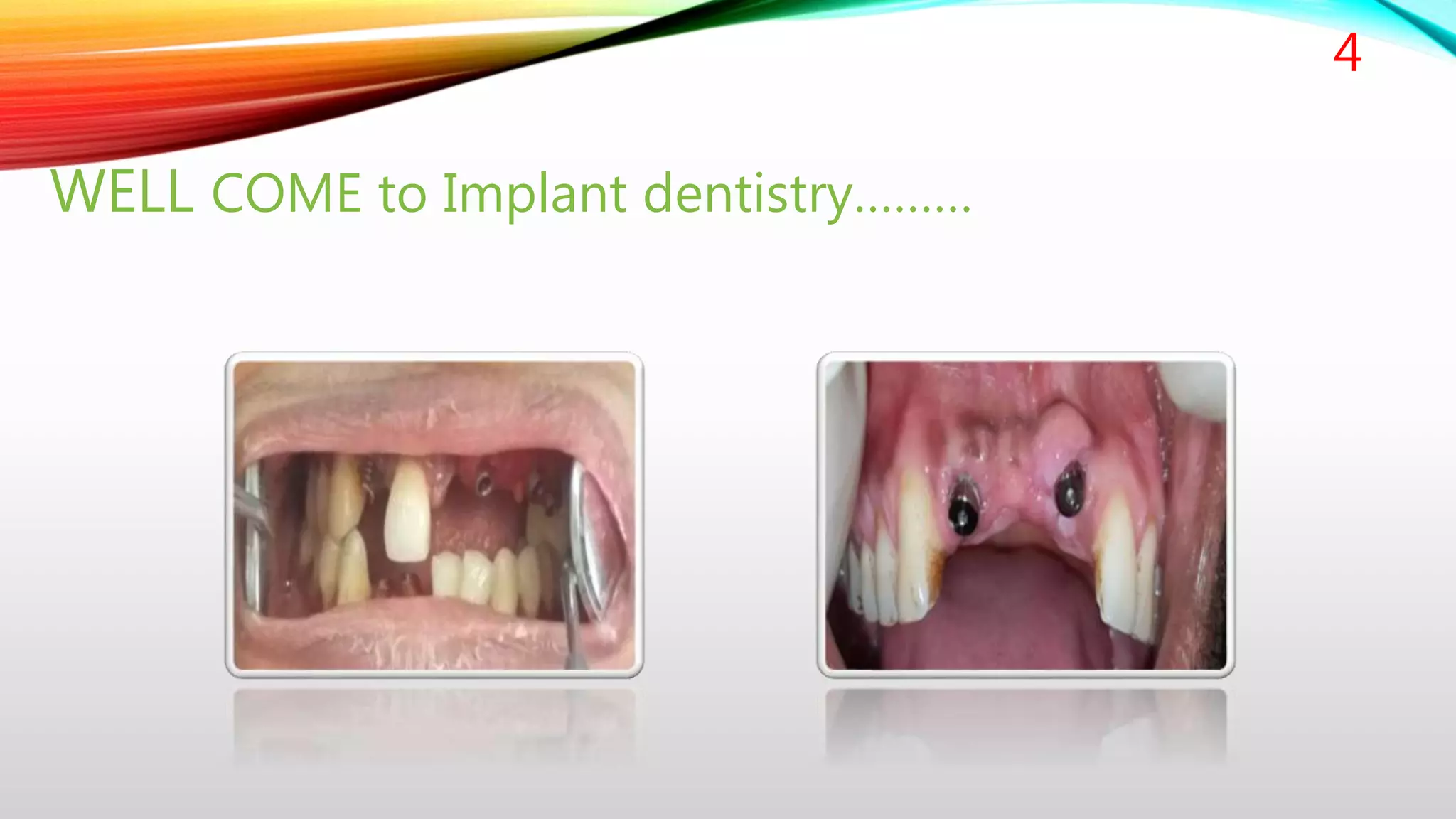 Overview of impression technique in implant dentistry.pptx