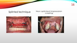 Overview of impression technique in implant dentistry.pptx