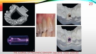 Overview of impression technique in implant dentistry.pptx