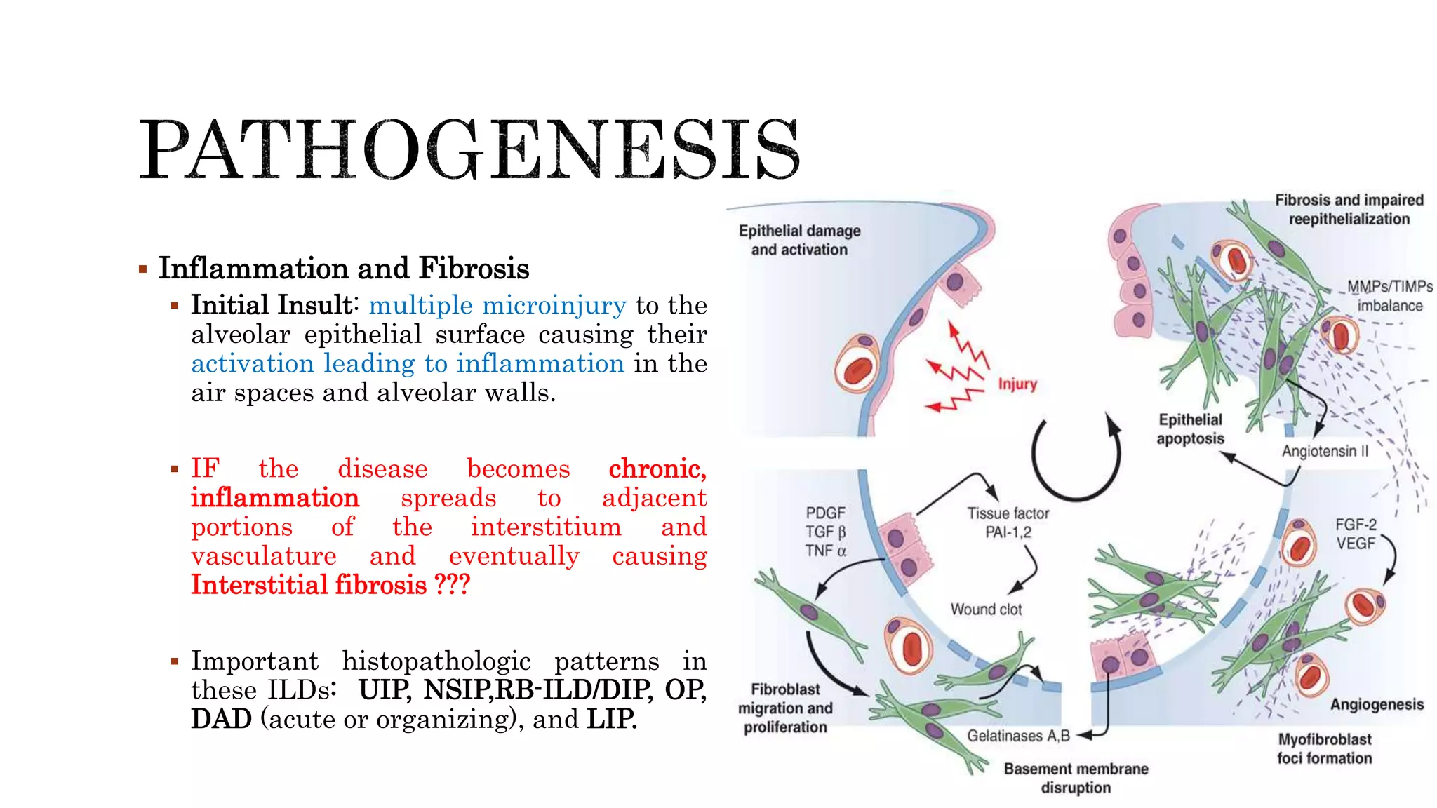 Overview of interstitial lung diseases | PPTX