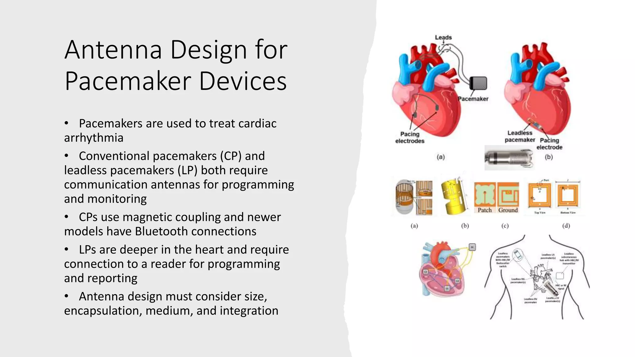 Overview of medical implant antennas by Ali Khaleghi.pptx