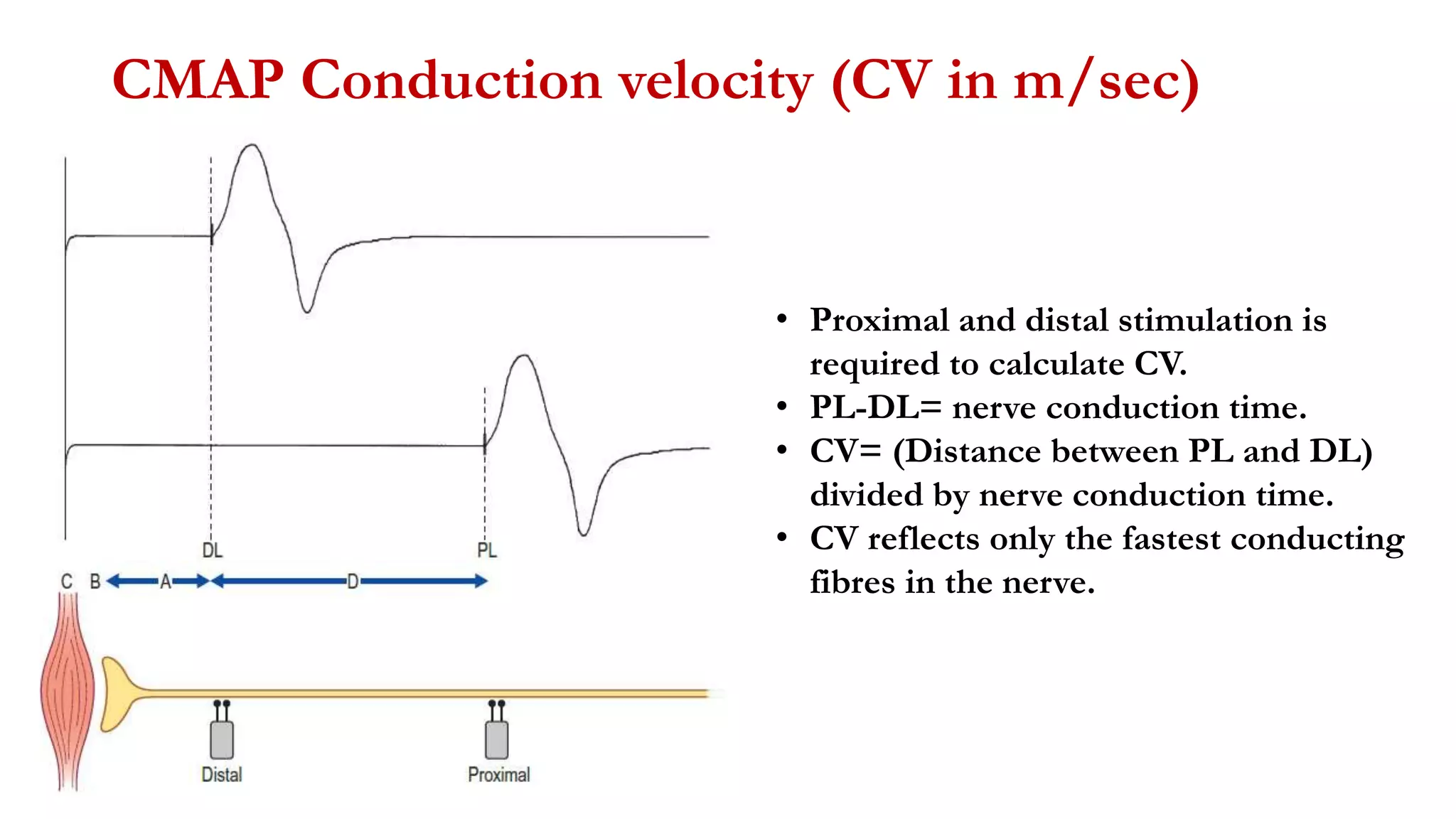 Overview of Nerve Conduction Study | PPTX