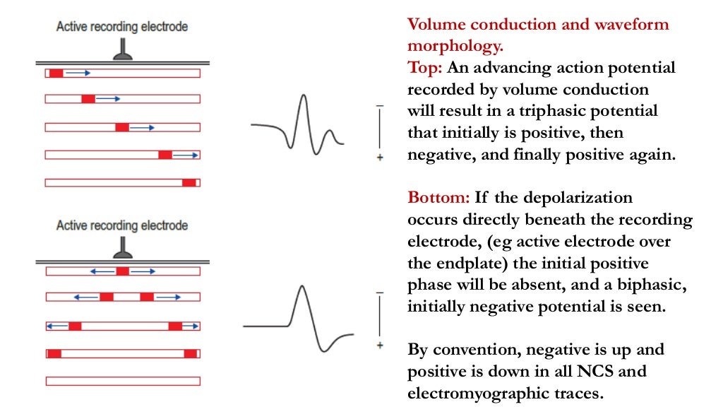 Overview of Nerve Conduction Study