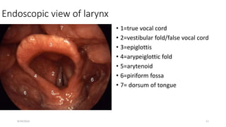 Overview of respiratory tract and pharynx [autosaved] (2) | PPTX